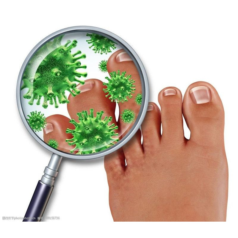 Wolf Venom Beriberi Spray Ointment Fungus Buster Feet Odor Itch Blister ...