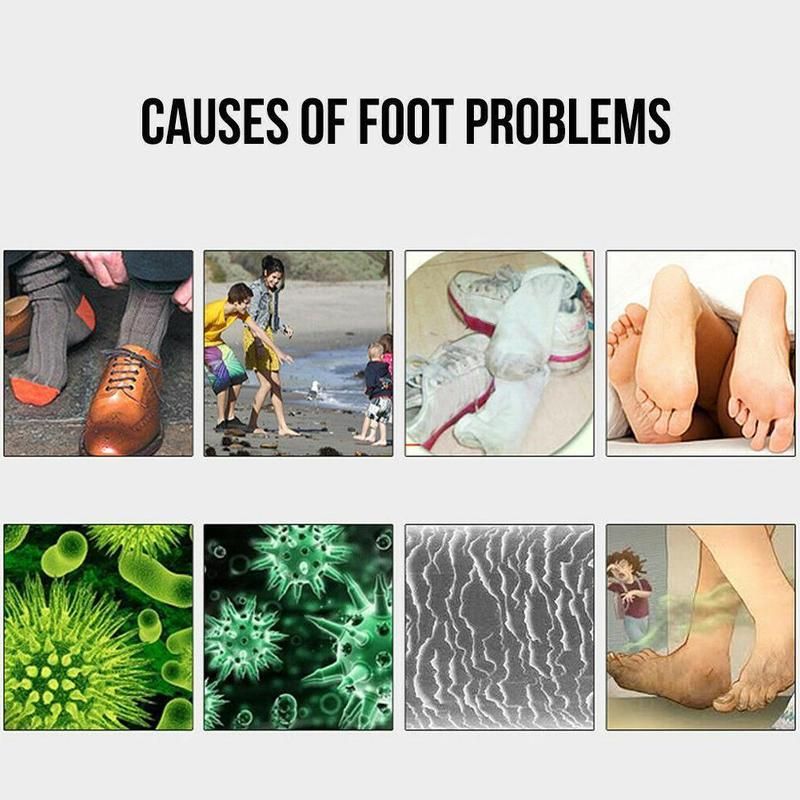 Wolf Venom Beriberi Spray Ointment Fungus Buster Feet Odor Itch Blister ...